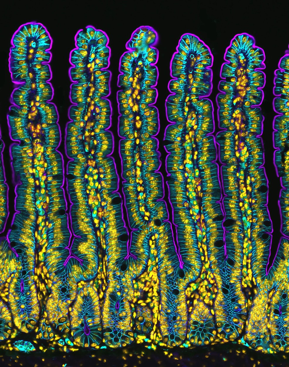Nikon Small World: confira imagens incríveis premiadas em competição de ...
