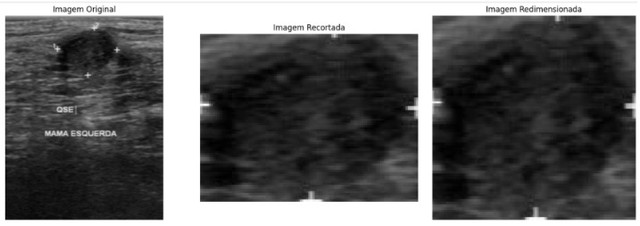 CPQD cria software de IA capaz de identificar diversos tipos de câncer