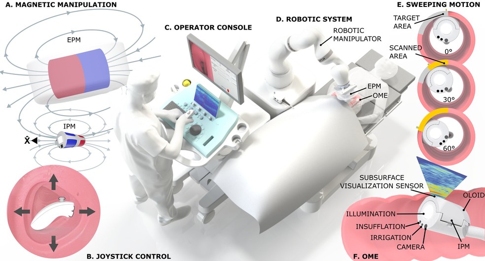 Pesquisadores desenvolvem mini robô que poderá fazer biópsia virtual de ...