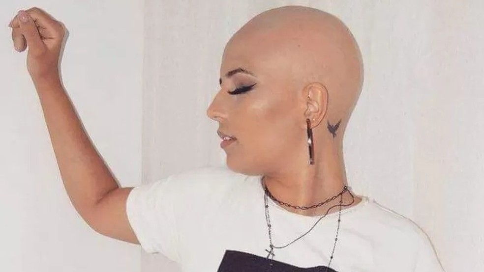 Cabeleireira fica careca após diagnóstico de alopecia: 'perdi os fios e ...