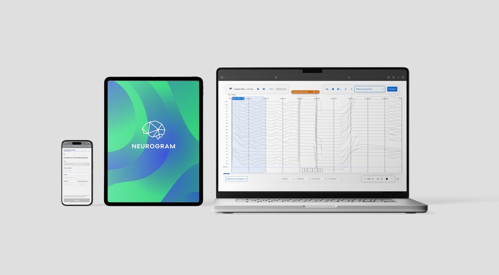 Neurogram, de IA para análise neurológica, prevê ampliar em 900% total ...